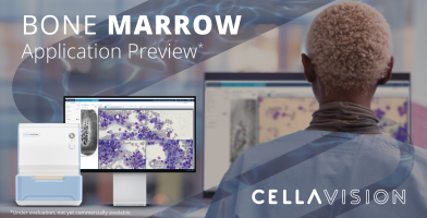 Releasing digitalized feathered edge | CellaVision